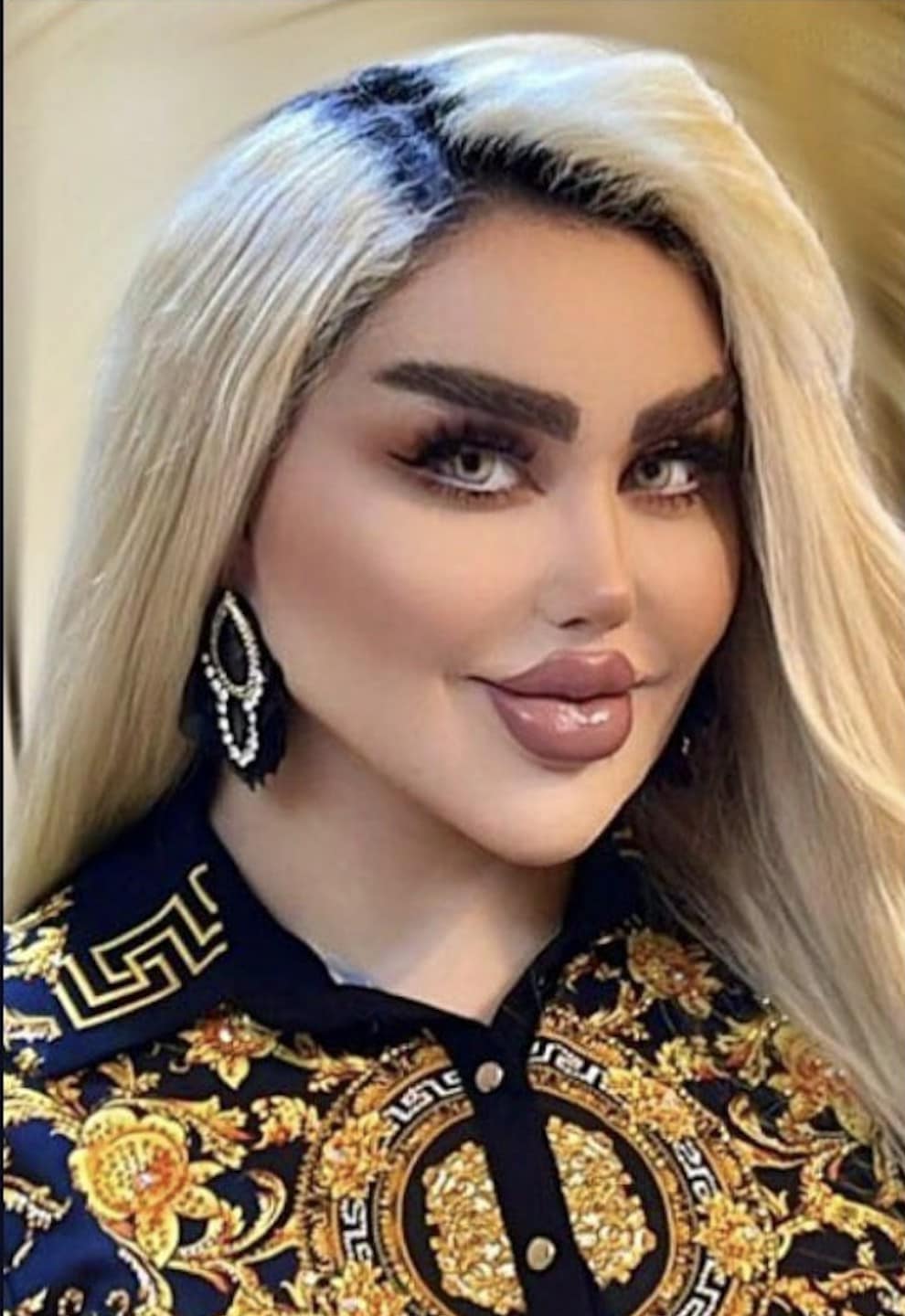 Woman’s 43 operations to look like Barbie backfire - Story