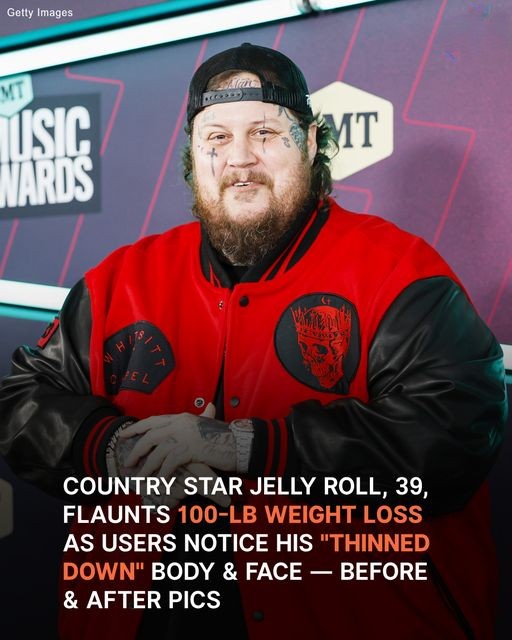 Country Singer Jelly Roll, 39, Wows Fans with 100-Lb Weight Loss: ‘Next ...